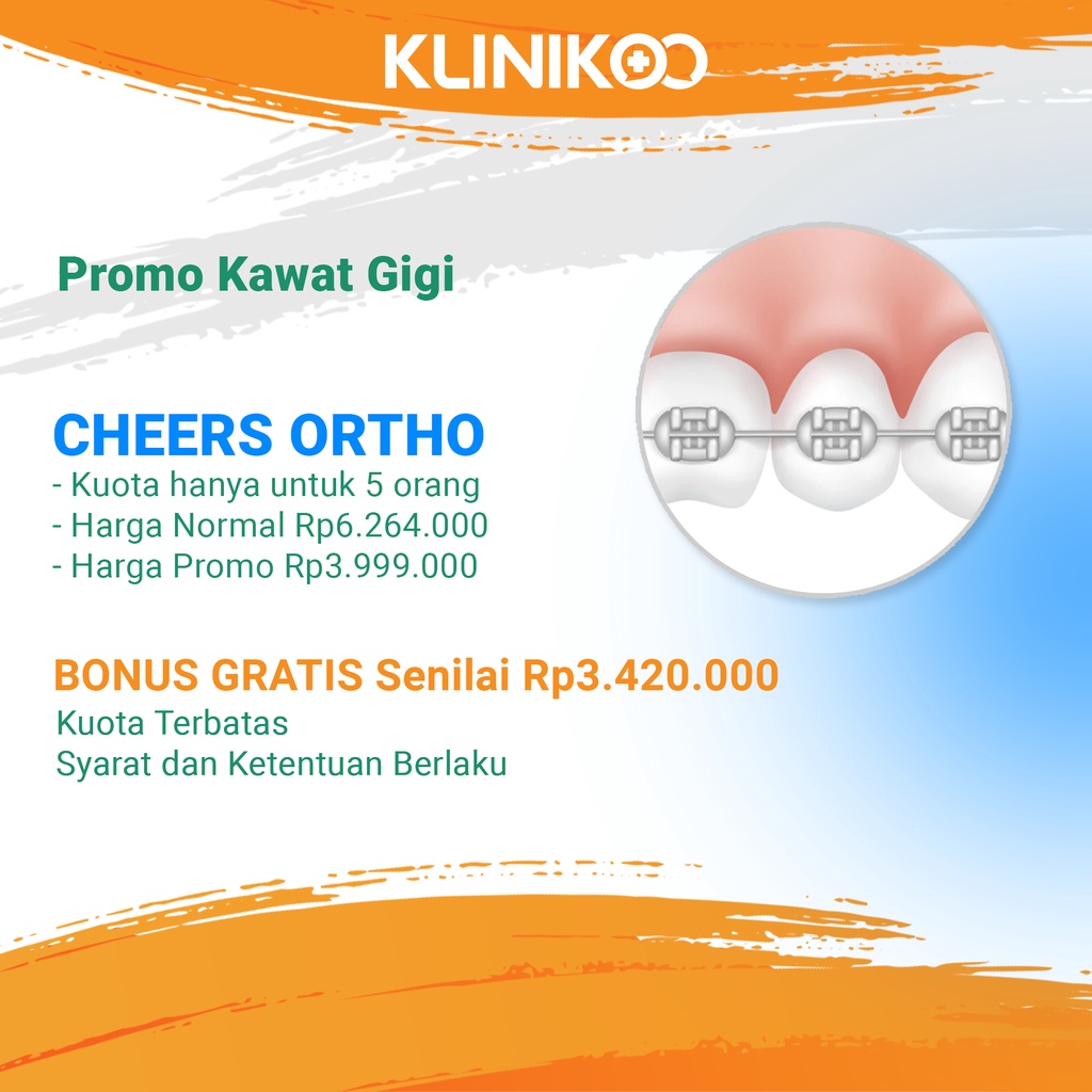 Jual Voucher Promo Kawat Gigi: CHEERS ORTHO | Shopee Indonesia