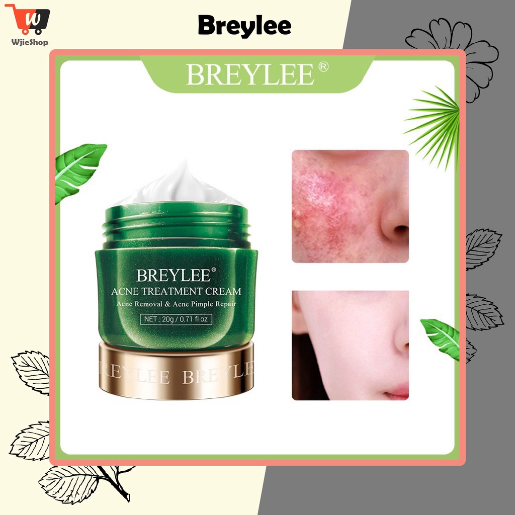 Jual Breylee Acne Treatment Cream (Acne Removal & Acne Pimple Repair) | Shopee Indonesia