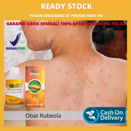 Jual Obat Rubeola Anak & Dewasa, Obat Gatal Rubeola, Ensefalitis ...