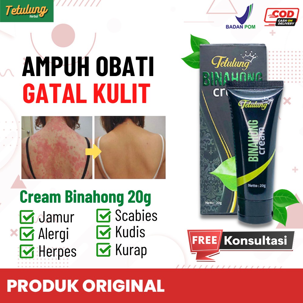 Jual CREAM BINAHONG LUKA DAN GATAL Ampuh, SALEP BINAHONG 20gr, TETULUNG ...