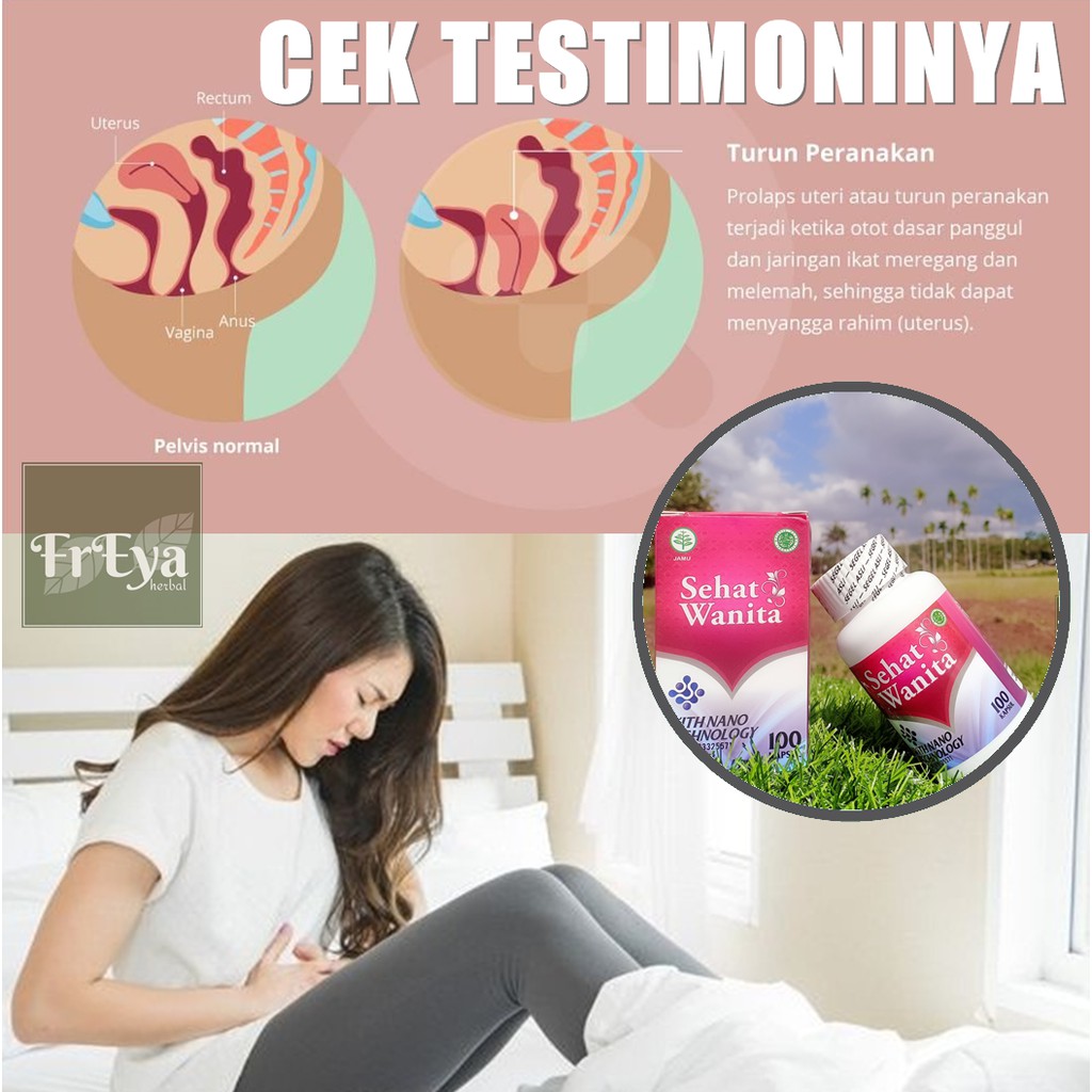 Jual OBAT TURUN PERANAKAN (RAHIM TURUN) ATAU PROLAPS UTERI PASCA ...