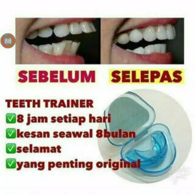 Jual PERAPI GIGI TRAINER ALIGNMENT | Shopee Indonesia