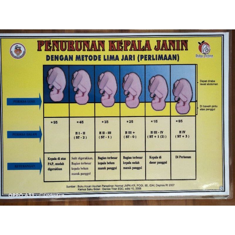 Jual (14) Poster Penurunan Kepala Janin dengan Metode 5 Jari | Shopee ...