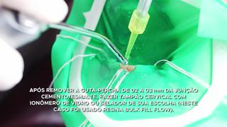 Jual AFHAM DENTAL ETCHING GEL GIGI DSP ETCH REGISTRASI AKL / ETSA ETCHA ...