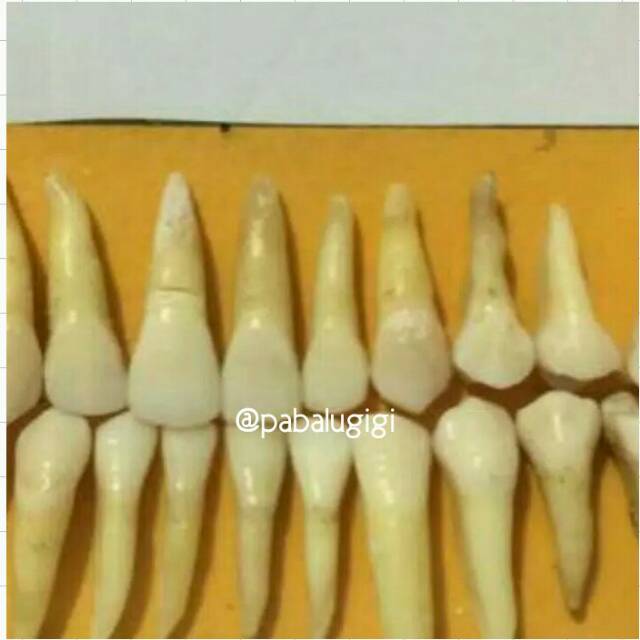 Jual GIGI PRAKTIKUM RAHANG ATAS JUAL SATUAN Insisif Caninus Premolar ...