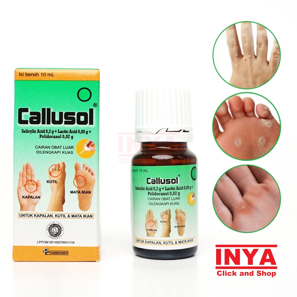 Jual CALLUSOL 10ml - Obat Kulit - Kapalan - Kutil - Mata Ikan ...