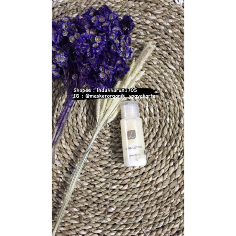 Jual ACNE LOTION LARISSA/Obat Jerawat LARISSA 30ml ORI 100% From Gerai ...