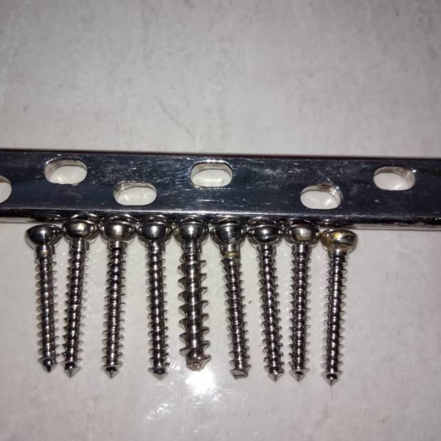 Jual Pen Platina Patah Tulang untuk PAHA ATAU FEMUR | Shopee Indonesia