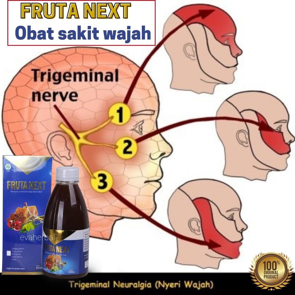 Jual Obat Trigeminal Neuralgia / Gangguan Pada Saraf Trigeminal | 100% ...