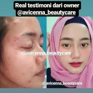 Jual Testimoni Terlengkap & Harga Terbaru Oktober 2025 | Shopee Indonesia