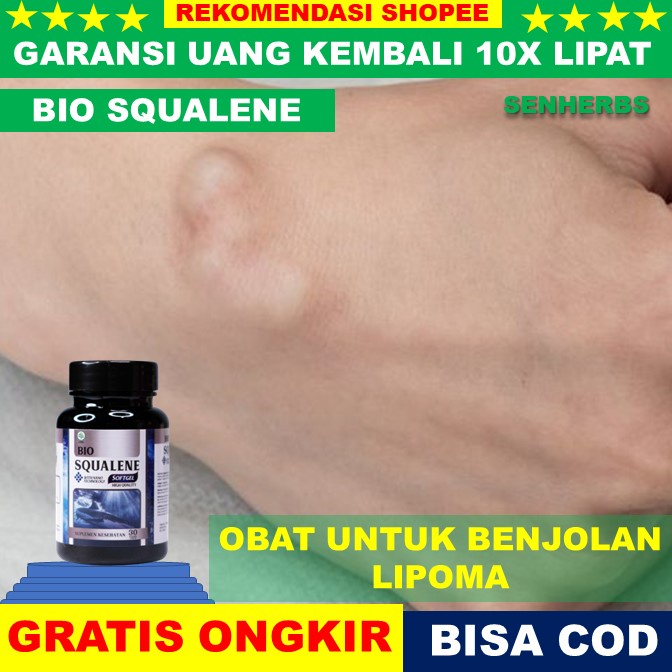 Jual Obat benjolan lemak (Lipoma) Benjolan di tangan, Benjolan Di perut ... Jual Obat benjolan lemak (Lipoma) Benjolan di tangan, Benjolan Di perut ...
