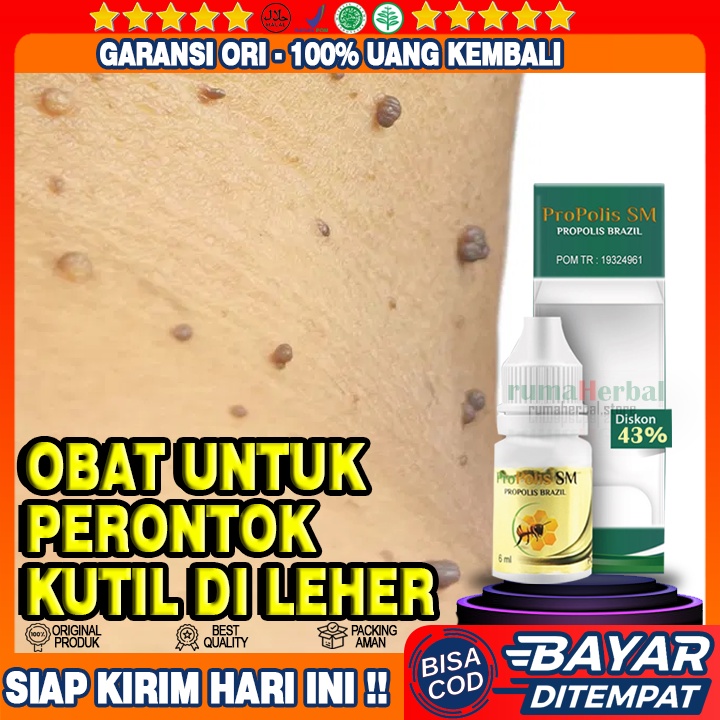 Jual Obat Perontok Kutil Di Leher, Daging Jadi, Obat Papiloma, Skin Tag ...