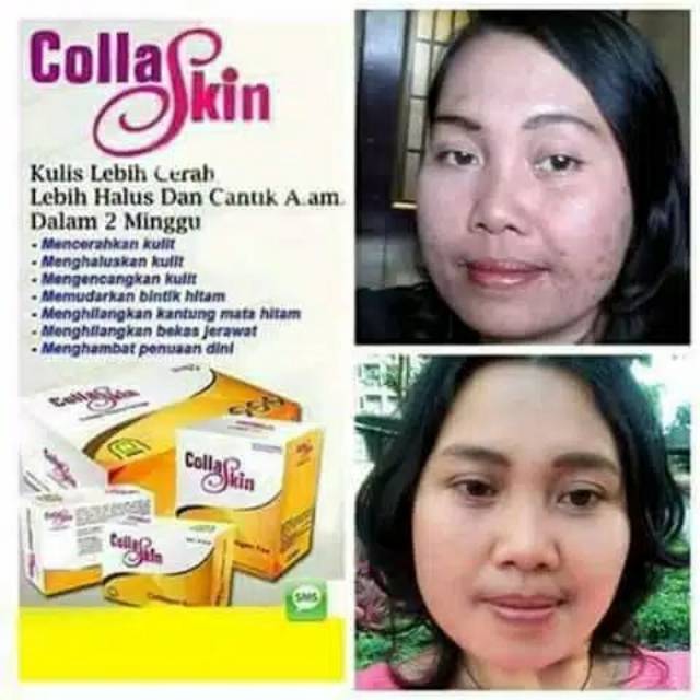 Jual Collagen collaskin asli Nasa | Shopee Indonesia