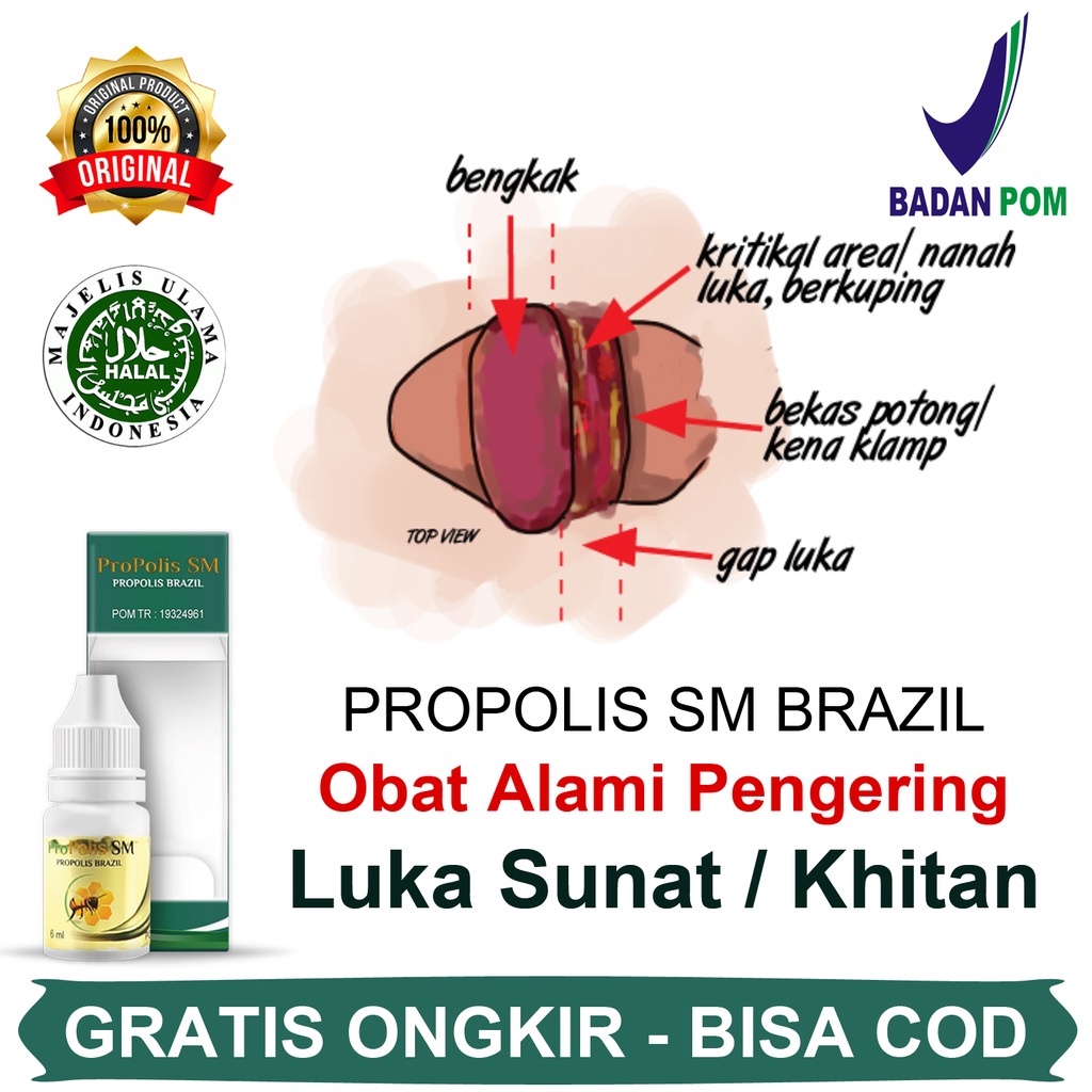 Jual Obat Salep Pengering Luka Sunat Obat Oles Luka Sunat Obat Luka ... Jual Obat Salep Pengering Luka Sunat Obat Oles Luka Sunat Obat Luka ...