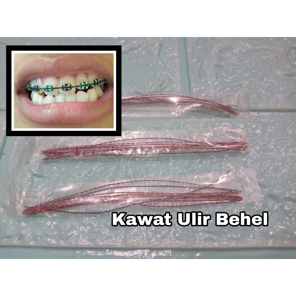 Jual Kawat Ulir Behel Kawat Behel Ulir Dental Wire | Shopee Indonesia