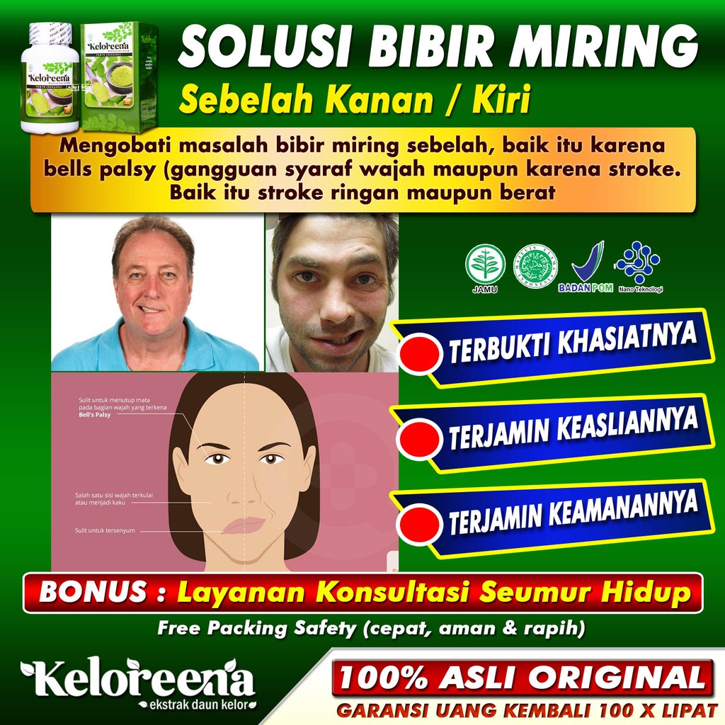 Jual Obat Herbal Bibir Miring Muka Mencong Wajah Melorot Sebelah Kanan Kiri Keloreena