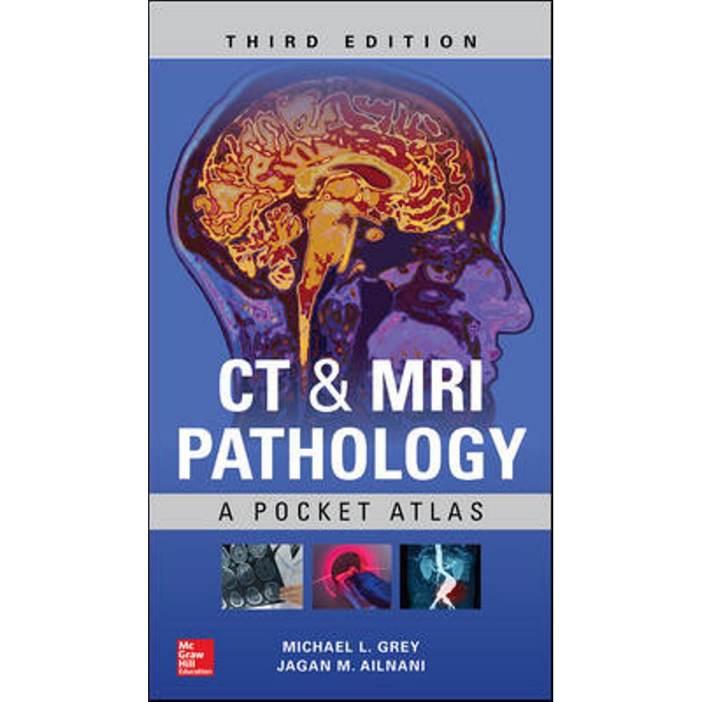 Jual CT & MRI Pathology: A Pocket Atlas (3rd Edition) | Shopee Indonesia