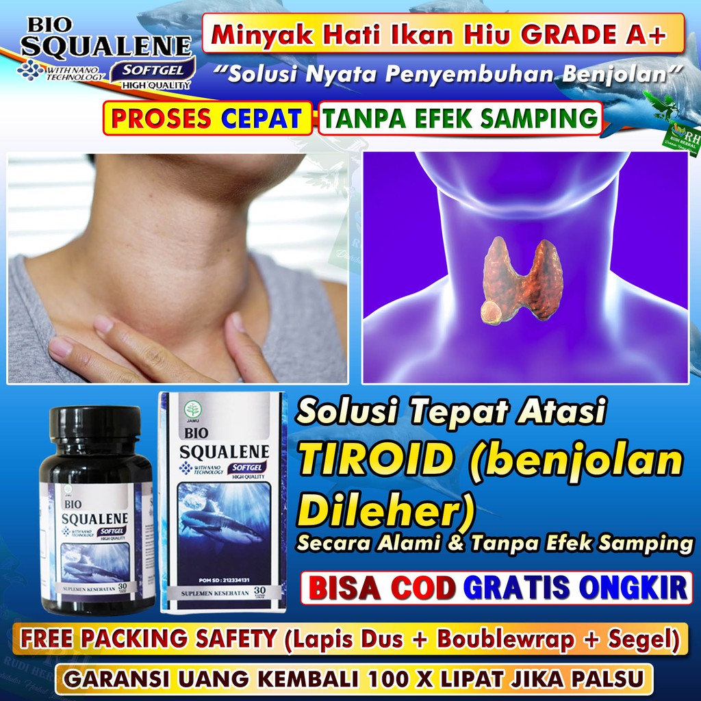 Jual Obat Tiroid, Benjolan Di Leher, Gondok Beracun, Nodul Tiroid ...