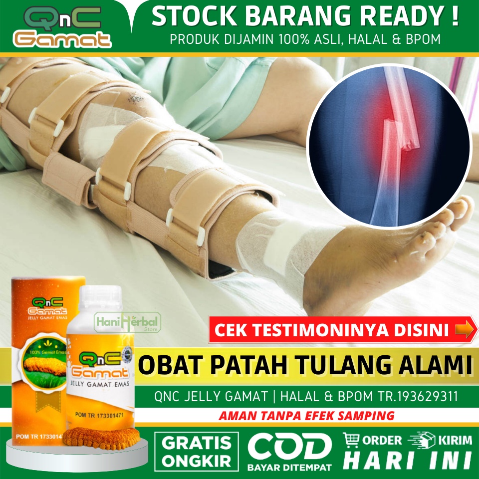 Jual OBAT PATAH TULANG DAN RETAK / REMUK - OBAT HERBAL PATAH TULANG ...