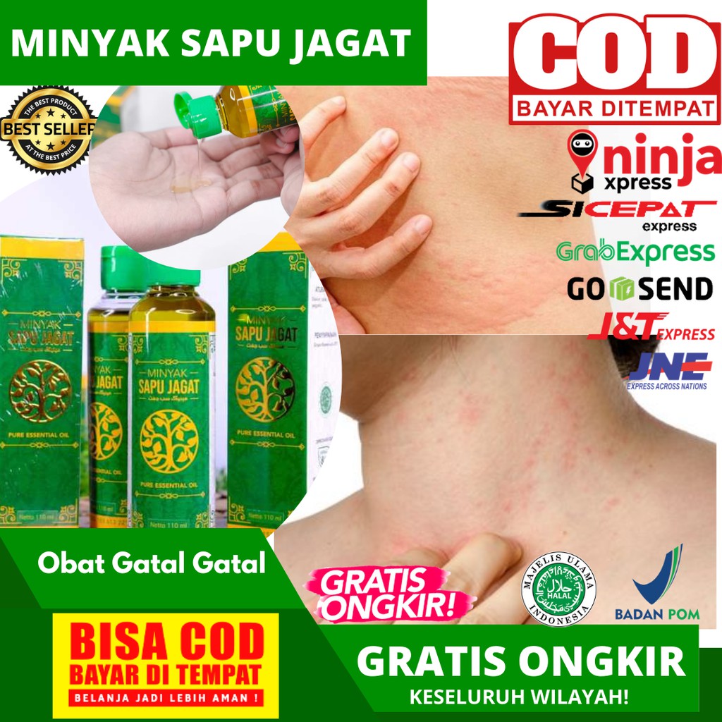 Jual Obat Gatal Pada Anak & Dewasa, Gatal Gatal, Kaligata, Gatal Alergi ...