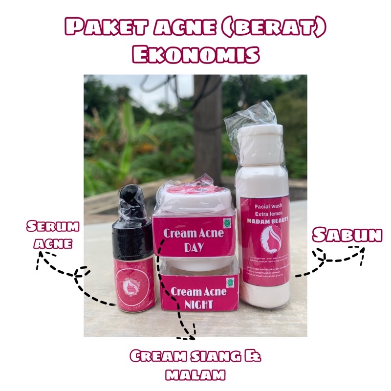 Jual paket Acne(berat) | Shopee Indonesia
