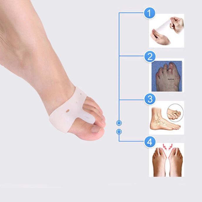 Jual FINGER PROTECTOR SILICONE TOE HALLUX VALGUS SEPARATORS | Shopee ...