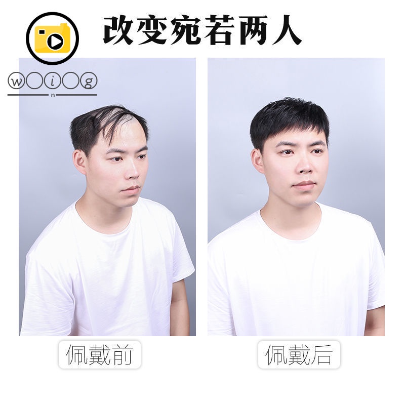 Jual Pria wig pengganti blok clamshell patch rambut penutup tenunan ...