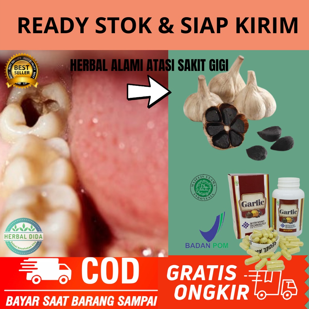 Jual Obat Sakit Gigi, Obat Sakit Gigi Berlubang, Obat sakit gusi ...