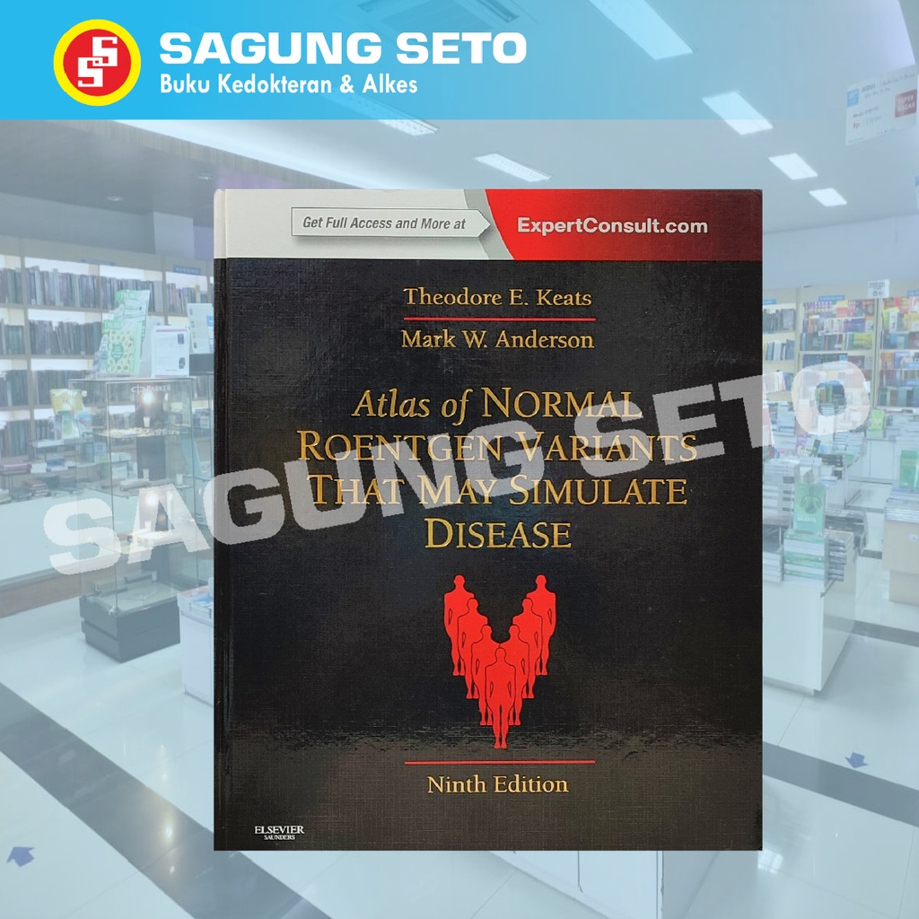 Jual BUKU ATLAS OF NORMAL ROENTGEN VARIANTS THAT MAY SIMULATE - KEATS ...
