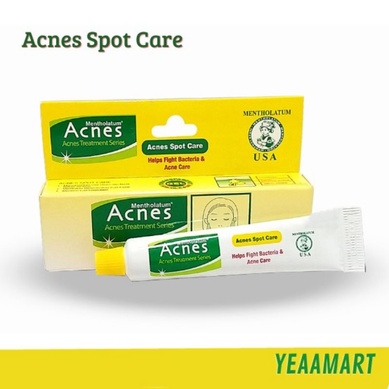 Jual Acnes Spot Care 12 Gr | Gel Penghilang Bekas Jerawat | Shopee ...