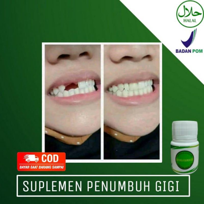 Jual SUPLEMEN PENUMBUH GIGI OMPONG KROPOS DAN BERLUBANG | Shopee Indonesia