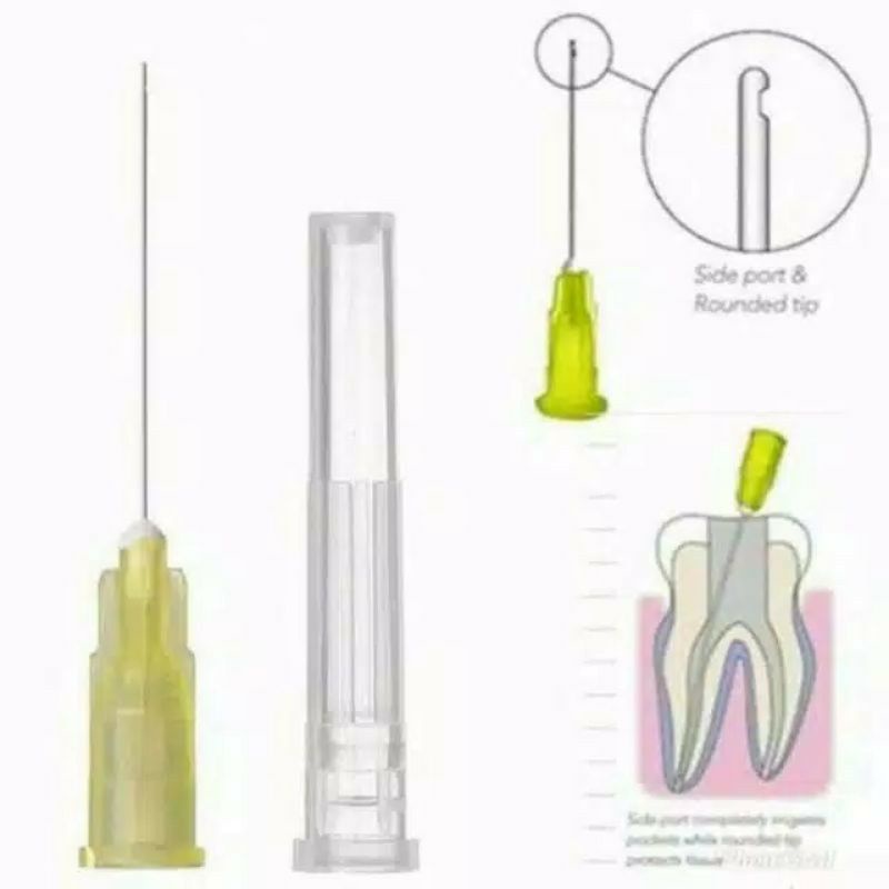 Jual jarum irigasi // spuit irigasi // dental // suction endo | Shopee ...