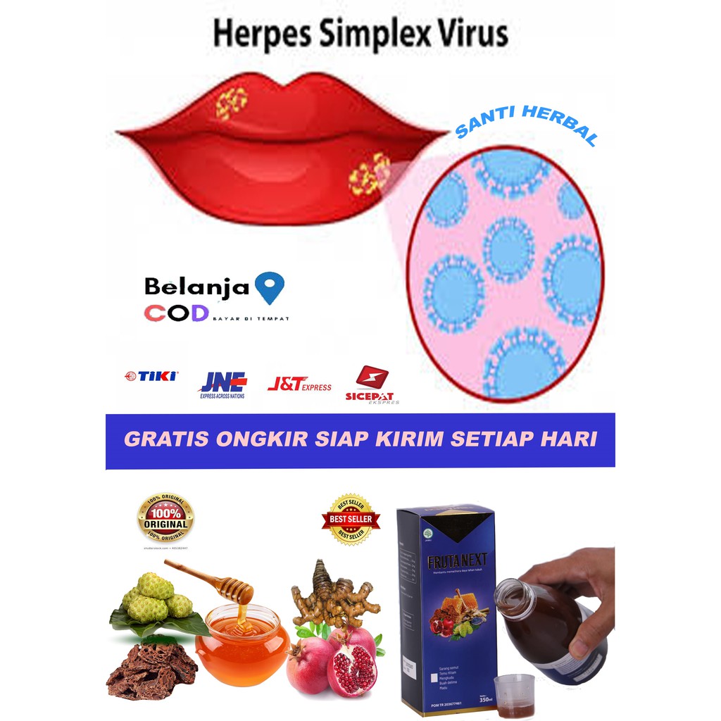 Jual Obat Cacar Api Herpes Zoster, Cacar Ular untuk Anak dan Dewasa ...