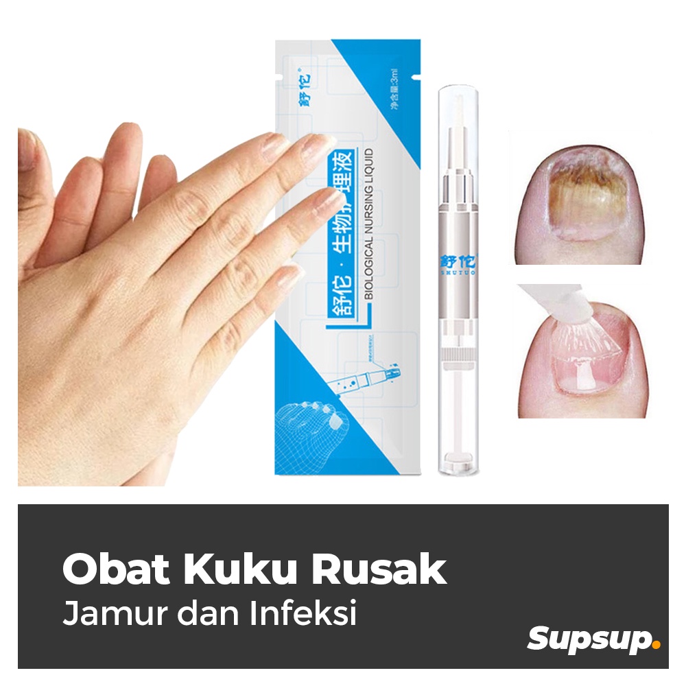 Jual Obat Kuku Rusak Berjamur Infeksi Cairan Pencil Liquid | Shopee ...