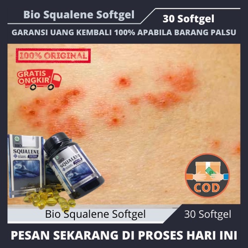Jual Obat Herpes Zoster, Nyeri Herpes Zoster, Penyakit Kulit Herpes ...