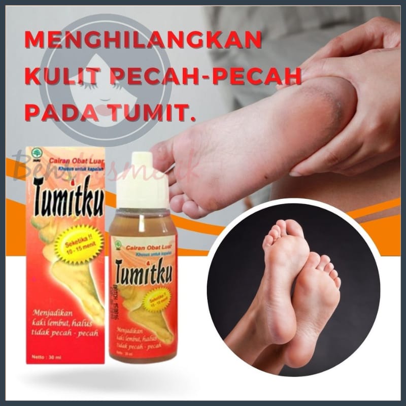 Jual TUMITKU OBAT HERBAL MENGATASI KAKI PECAH PECAH | Shopee Indonesia