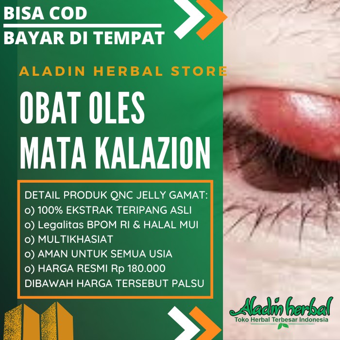 Jual [ COD ] - Obat Kalazion Oles 100% Herbal Alami - Benjolan di mata ...