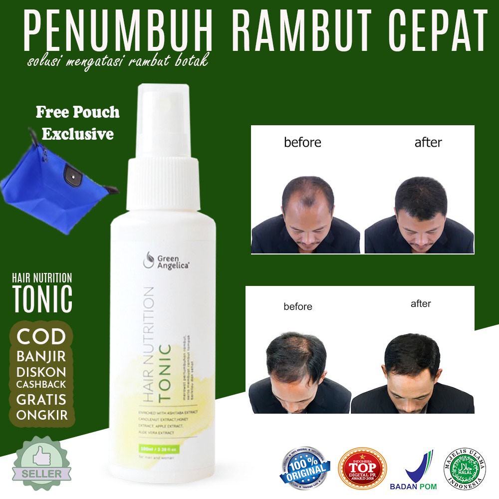 Jual Obat Penumbuh Rambut Botak dan Kerontokan Parah, Herbal Alami ...