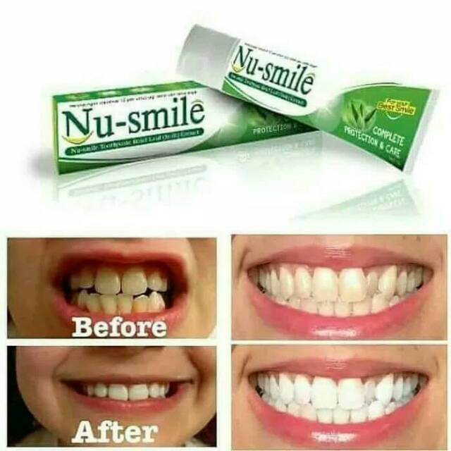 Jual NU-SMILE toothpaste / Pasta Gigi Nu Smile Original HWI | Shopee ...