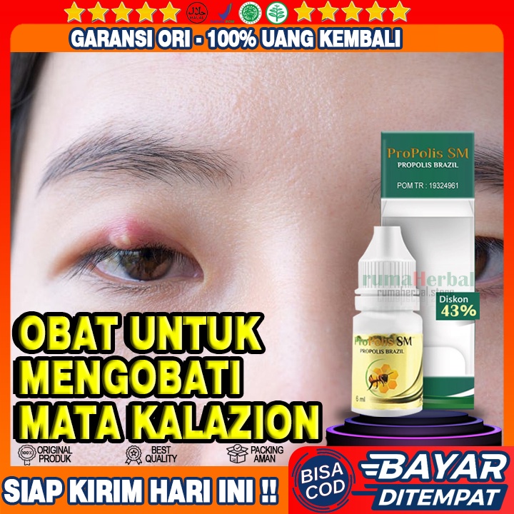 Jual Obat Mata Kalazion - Benjolan di Kelopak Mata - Obat Benjolan Di ...
