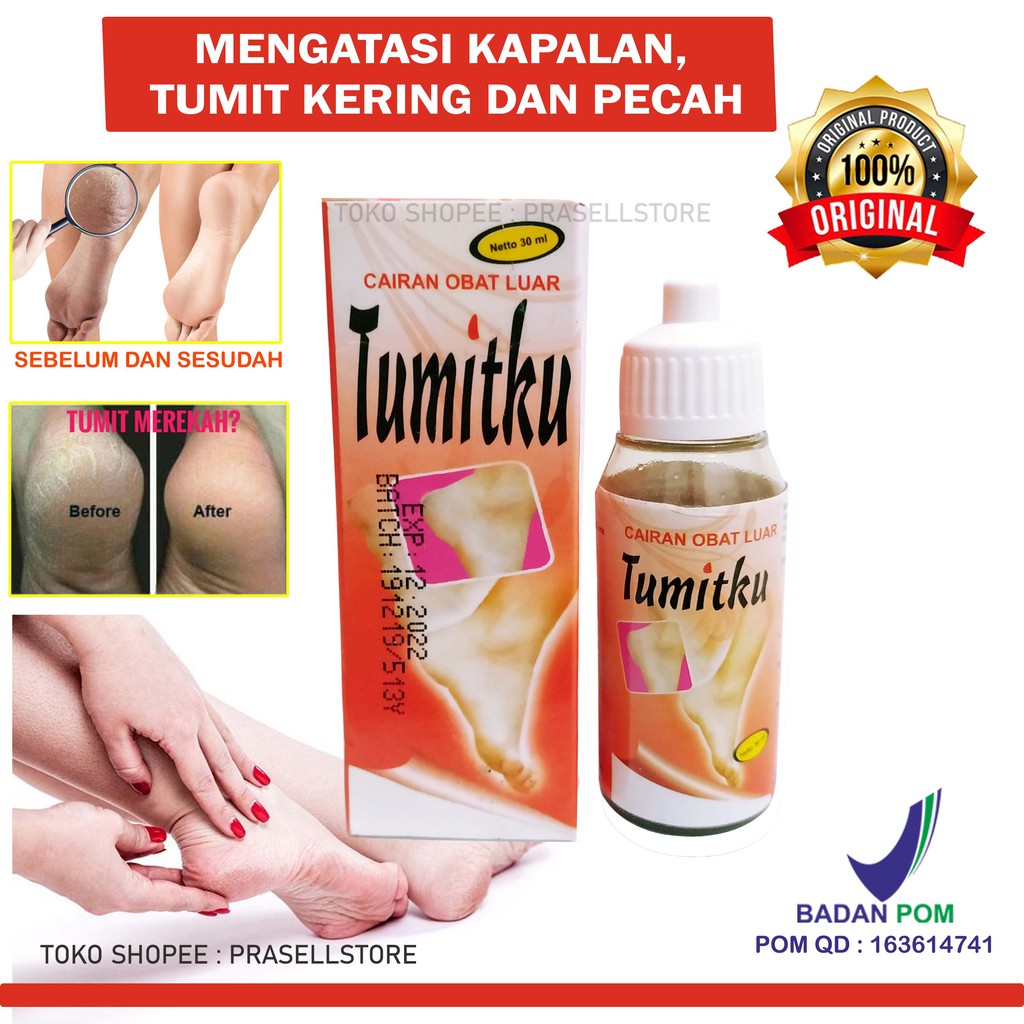 Jual Tumitku - Obat Kapalan dan Kaki Pecah-Pecah 30ml 100% Original ...