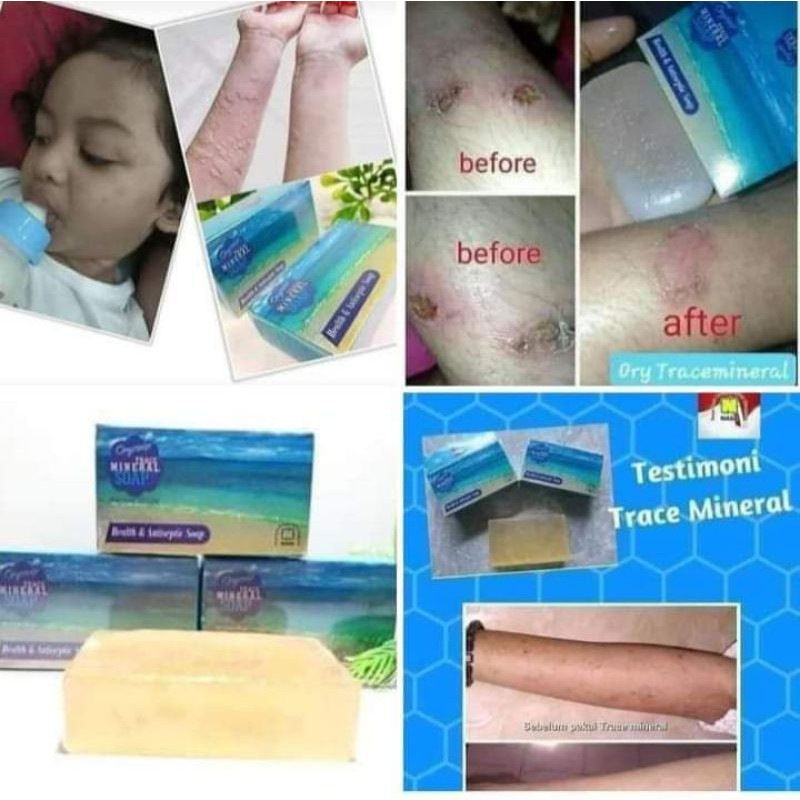 Jual TRACEMINERAL SOAP NASA sabun herbal anti septik,dapat mengatasi ...