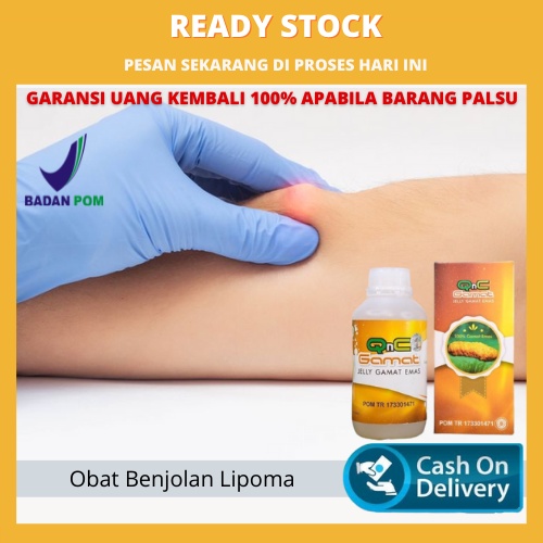 Jual Obat Lipoma Alami, Kelenjar Lipoma, Kanker Lipoma, Benjolan Isi ...
