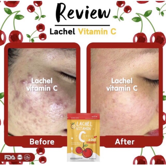Jual Lachel Vitamin C Vit C 2 in 1 | Shopee Indonesia