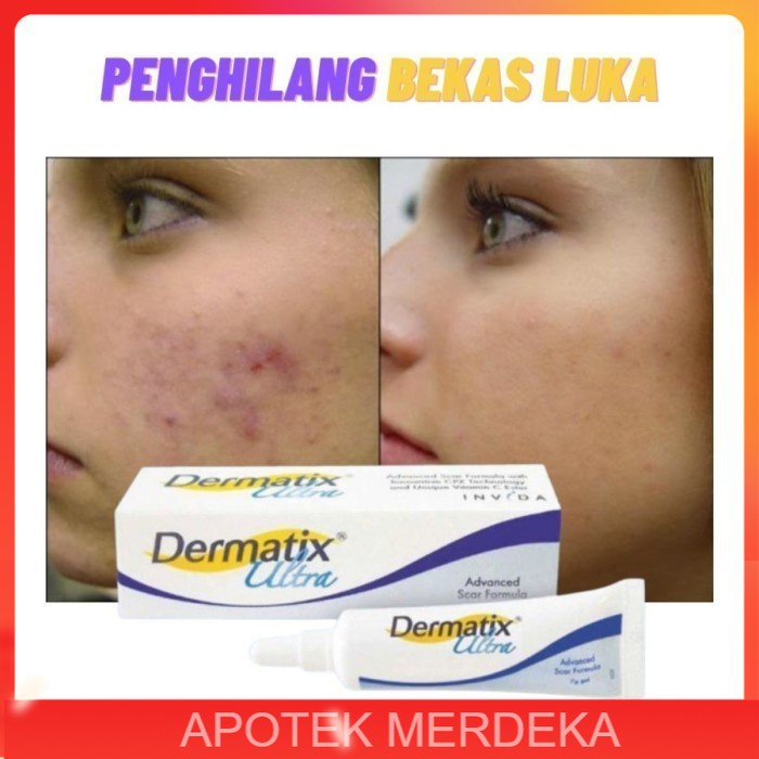 Jual Dermatix Ultra Gel Salep Penghilang Luka 5Gr Advanced Scar Formula ...