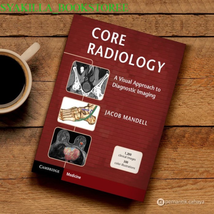 Jual BUKU BARU Core Radiology | Shopee Indonesia