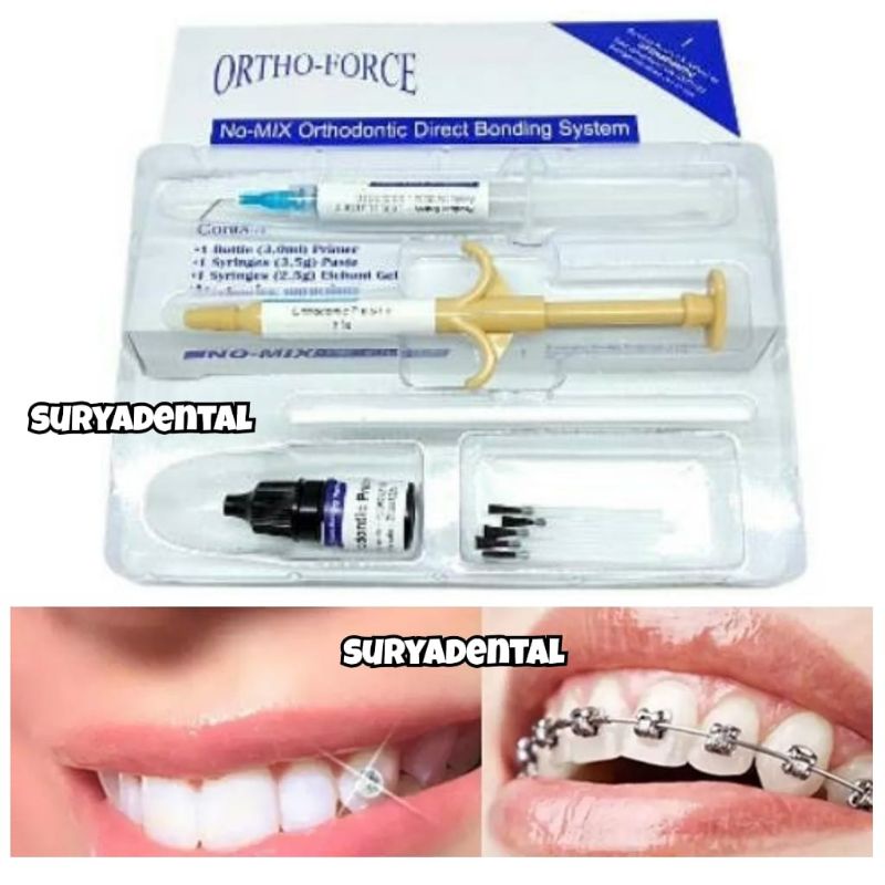 Jual Lem ORTHO FORCE NO LASER / NO-MIX Orthodontic Direct Bonding ...