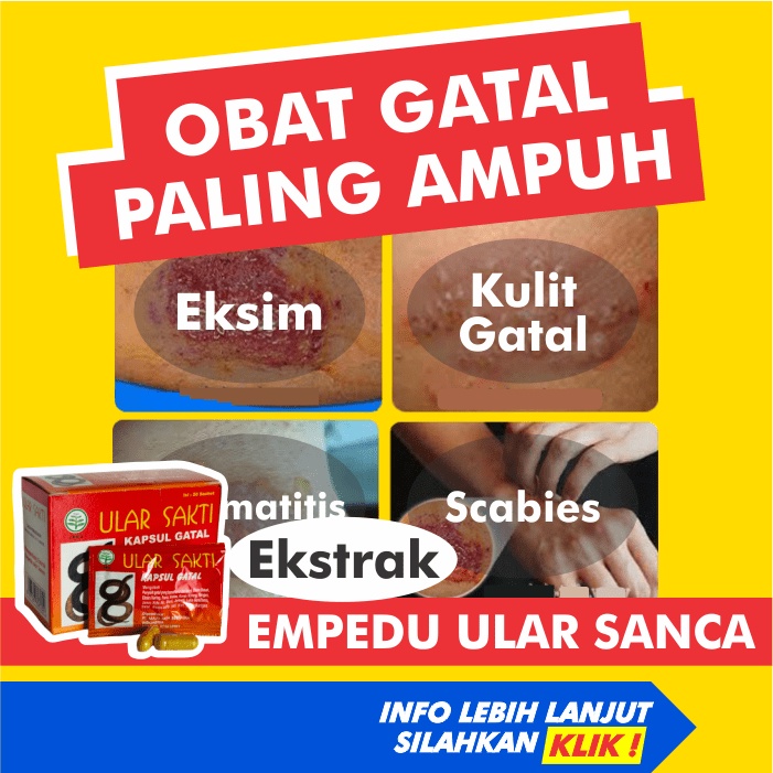 Jual Obat Gatal Gatel Paling Ampuh Kulit Eksim Exim Kering Basah ...