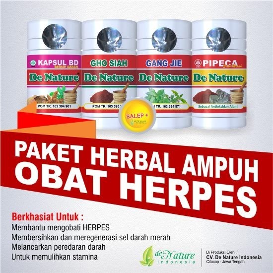Jual Obat Salep Cacar Ular Herbal Dampa Dompo Herpes Herves Zooster ...