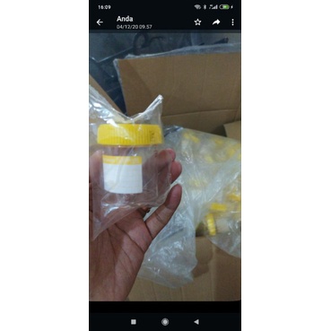 Jual Pot Urine Sterile Pot dahak pot sputum specimen container | Shopee ...